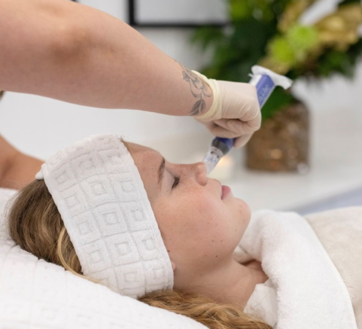 Skinpen Skin Needling - The Skin Clinicians